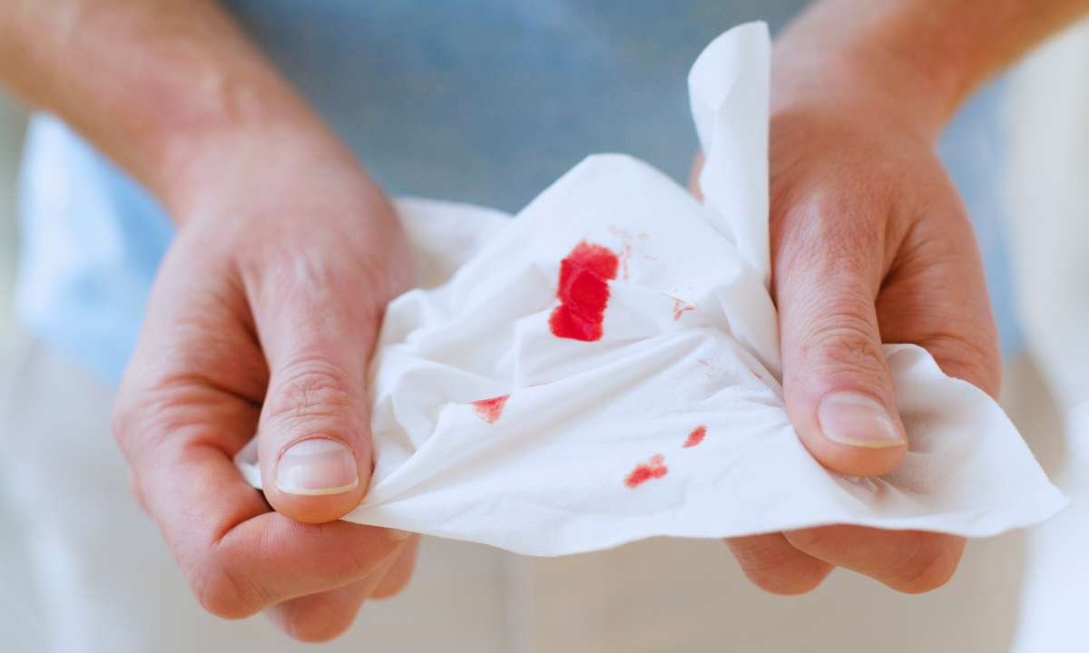Dreams About Bleeding Eyes (17 Meanings & Interpretations)