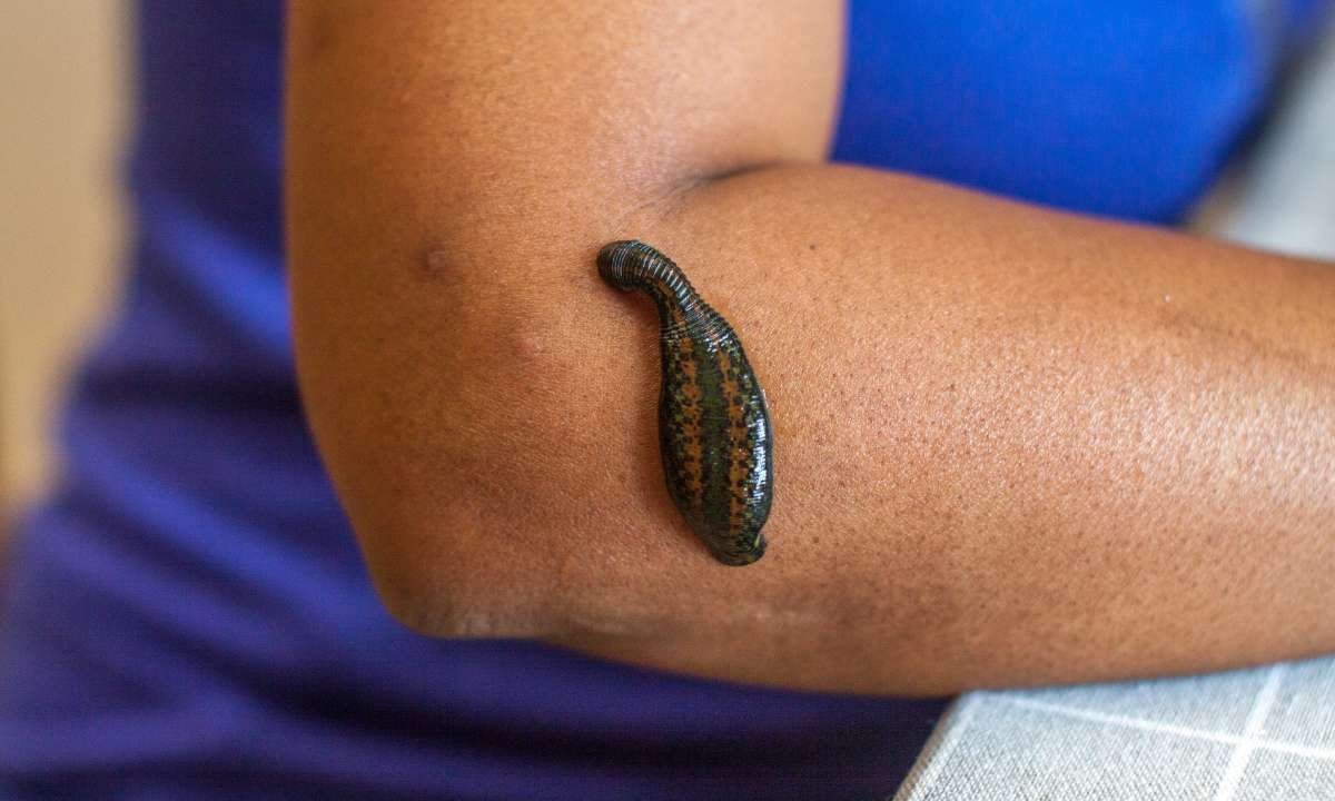 Dreams About Removing Leeches: Exploring Their Meaning For Kids