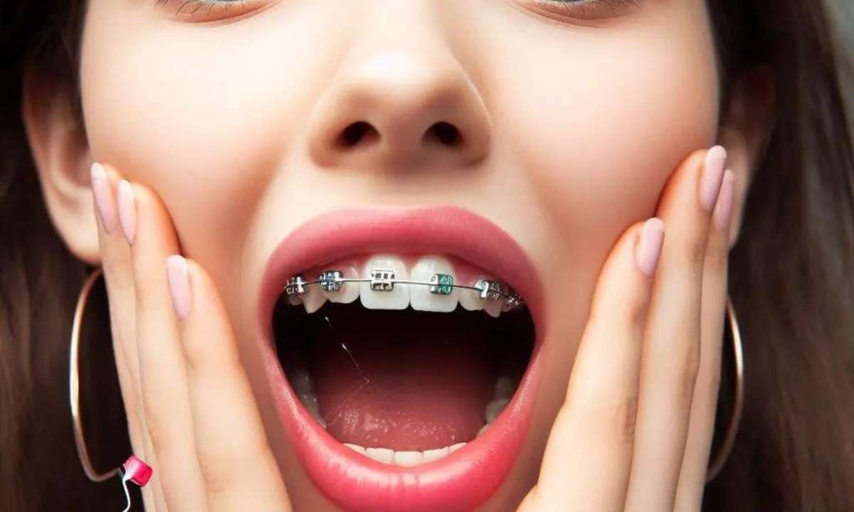 Dream About Braces Falling Off: Surprising Positive Meanings You’ll Love